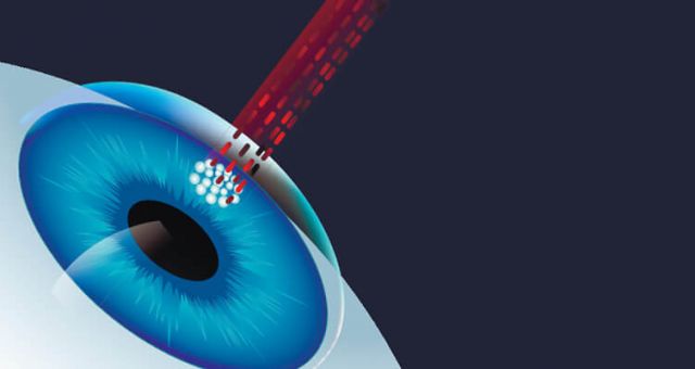 Focal Laser: Implications and Procedural Treatment