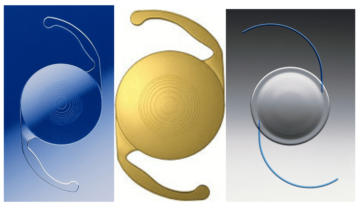 Intraocular Lenses: How To Choose Right One? | Neoretina