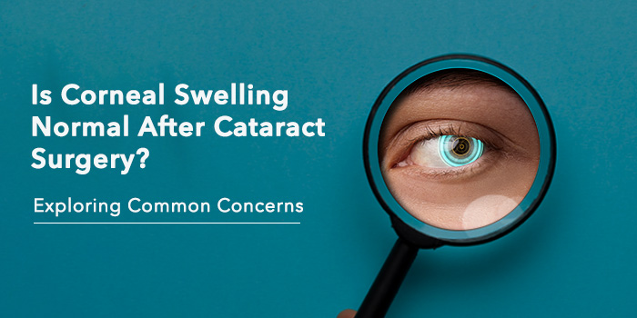 Is it typical to experience corneal swelling after cataract surgery