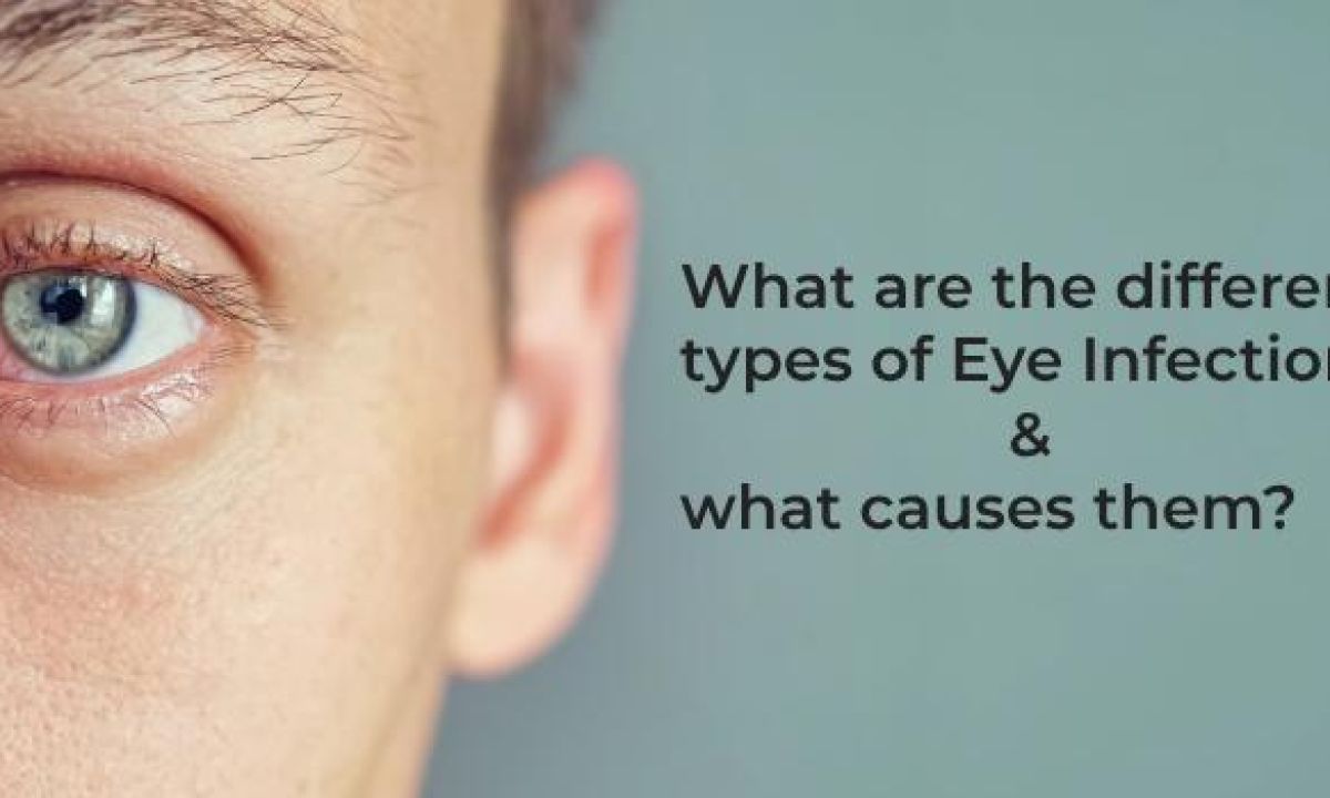 Types Of Bacterial Eye Infections IJMS | Free Full Text | An Omics