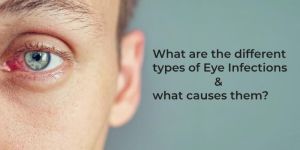 Different Types of Eye Infections and Their Causes | Neoretina
