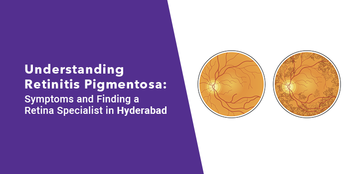 Retinitis Pigmentosa Care by Neoretina in Hyderabad