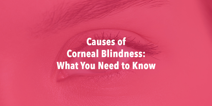 Causes of Corneal Blindness and Effective Prevention Tips