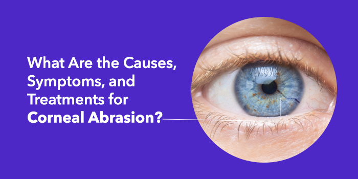 Corneal Abrasion: Causes, Symptoms, and Treatments at Neoretina