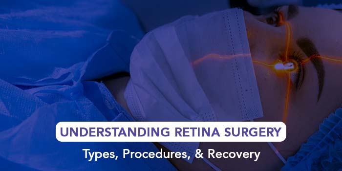Types of Retina Surgery and Procedure to Recovery