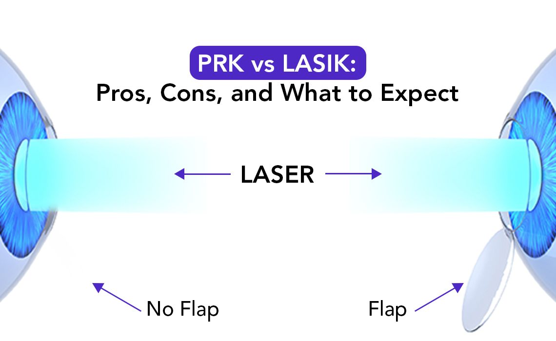 PRK vs LASIK: Which Laser Eye Surgery Is Best for You?