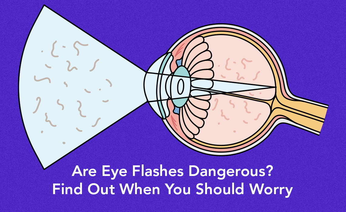 Are Eye Flashes Dangerous? Know When to See a Doctor