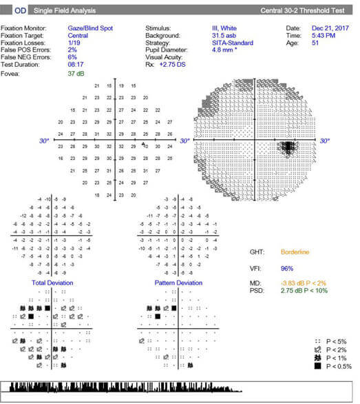 Visual Field s Instagram Twitter Facebook On IDCrawl